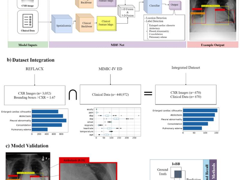 Mdf Net For Abnormality Detection By Fusing X Rays With Clinical Data Artificial Intelligence